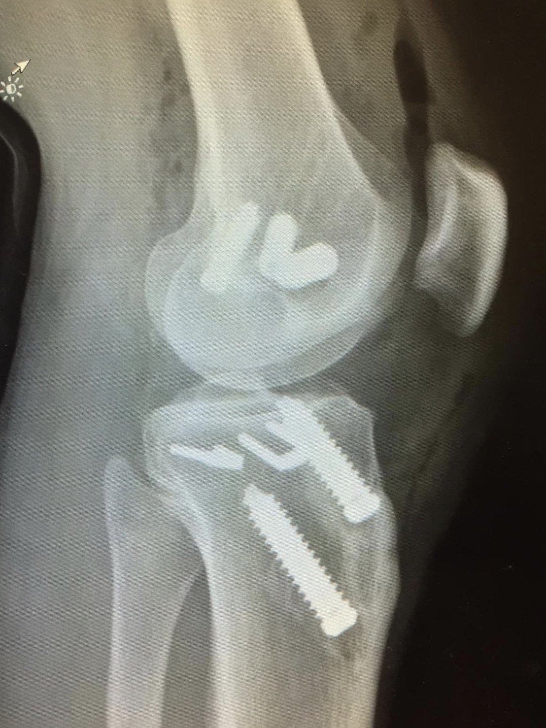 Knee Health: Resources for Injury Prevention & Treatment