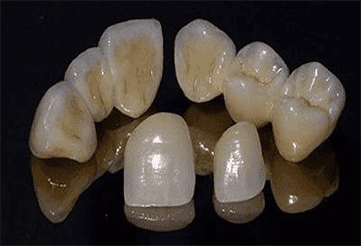 Corone e ponti - Salerno - Studio odontoiatrico Pisano