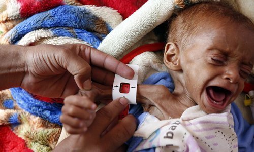 Why is there so much suffering in the world?