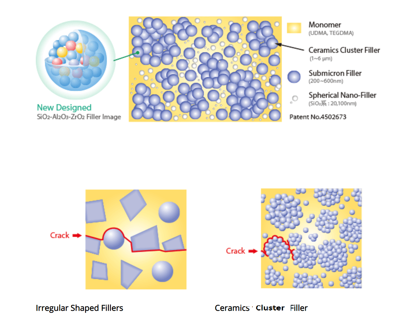 Composite Restorations