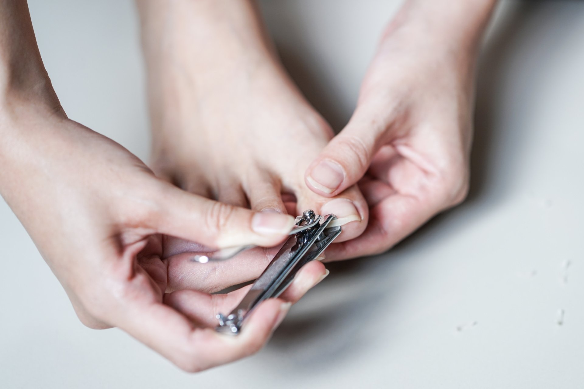 Keller Bunionectomy: Advantages and Disadvantages