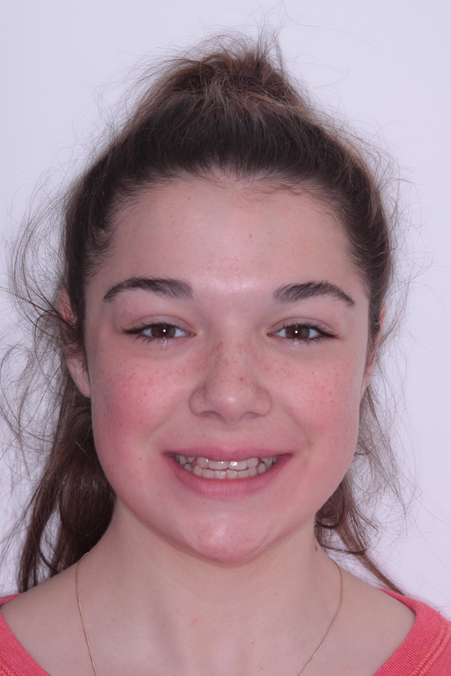 Orthodontics by Walmley Dental Practice