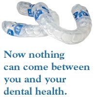 Perio Protect Method Carmel, CA - Carmel Family Dental