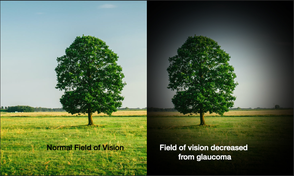 Centurion Eye Hospital