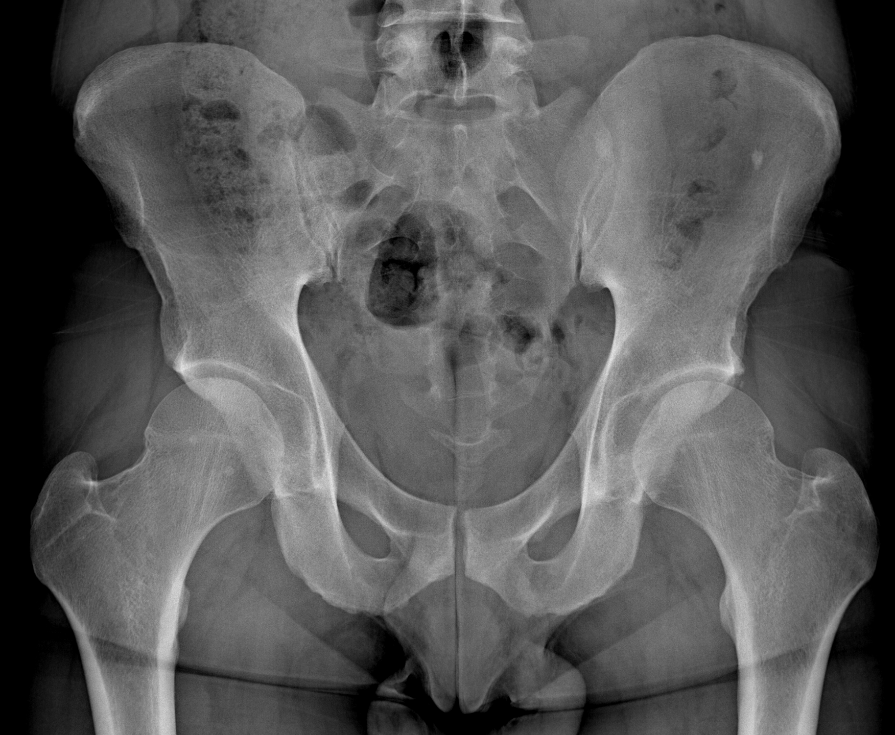 Specialisti in radiologia | Napoli | Di Pietto Dr. Luigi