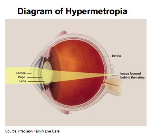 National Eye Health Week: Brief Overview of General Eye Care