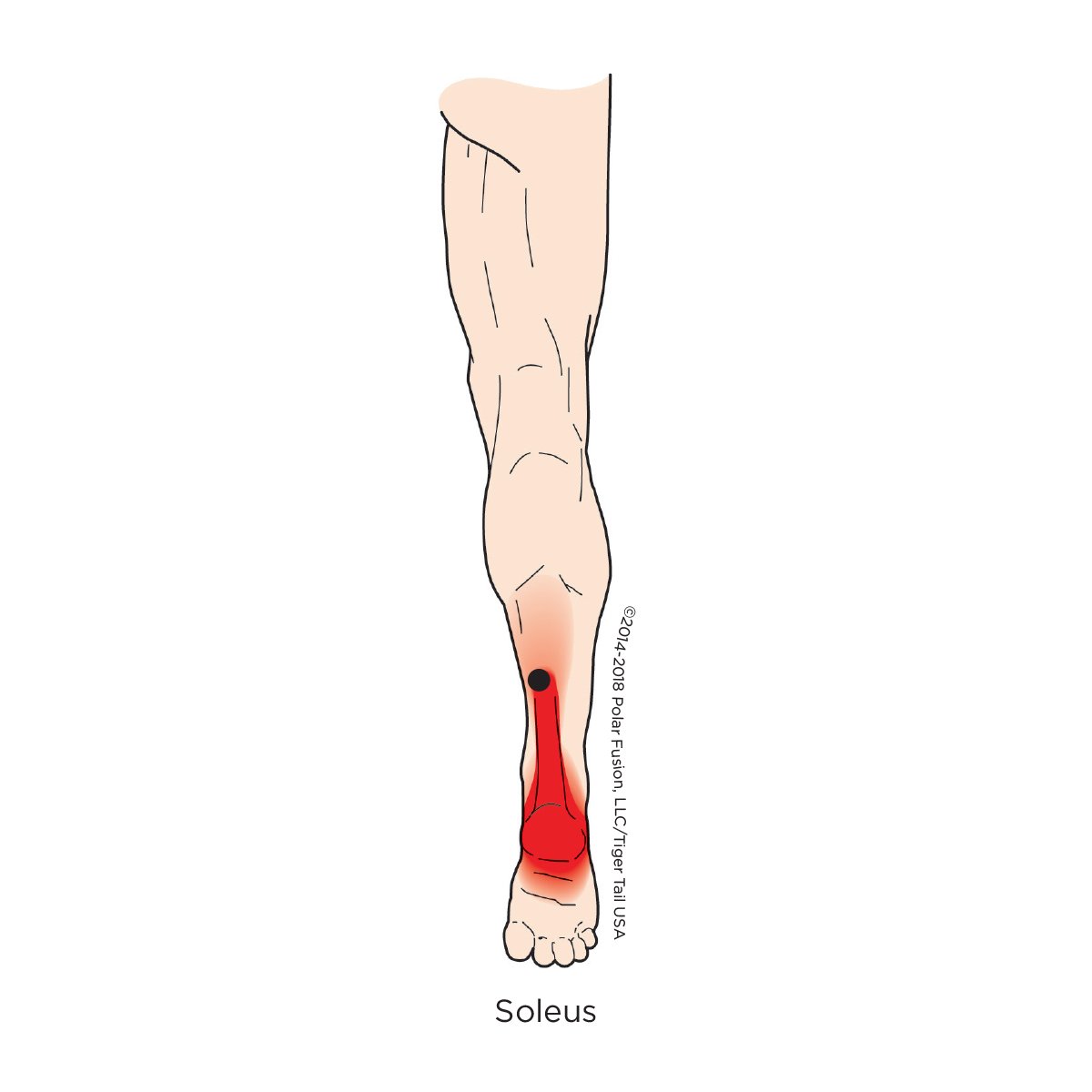 Trigger Point Therapy | Pain Relief Suggestions