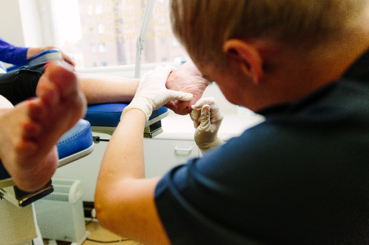 Verruca & Falknor's Verruca Needling Treatment | Newcastle Foot Clinic