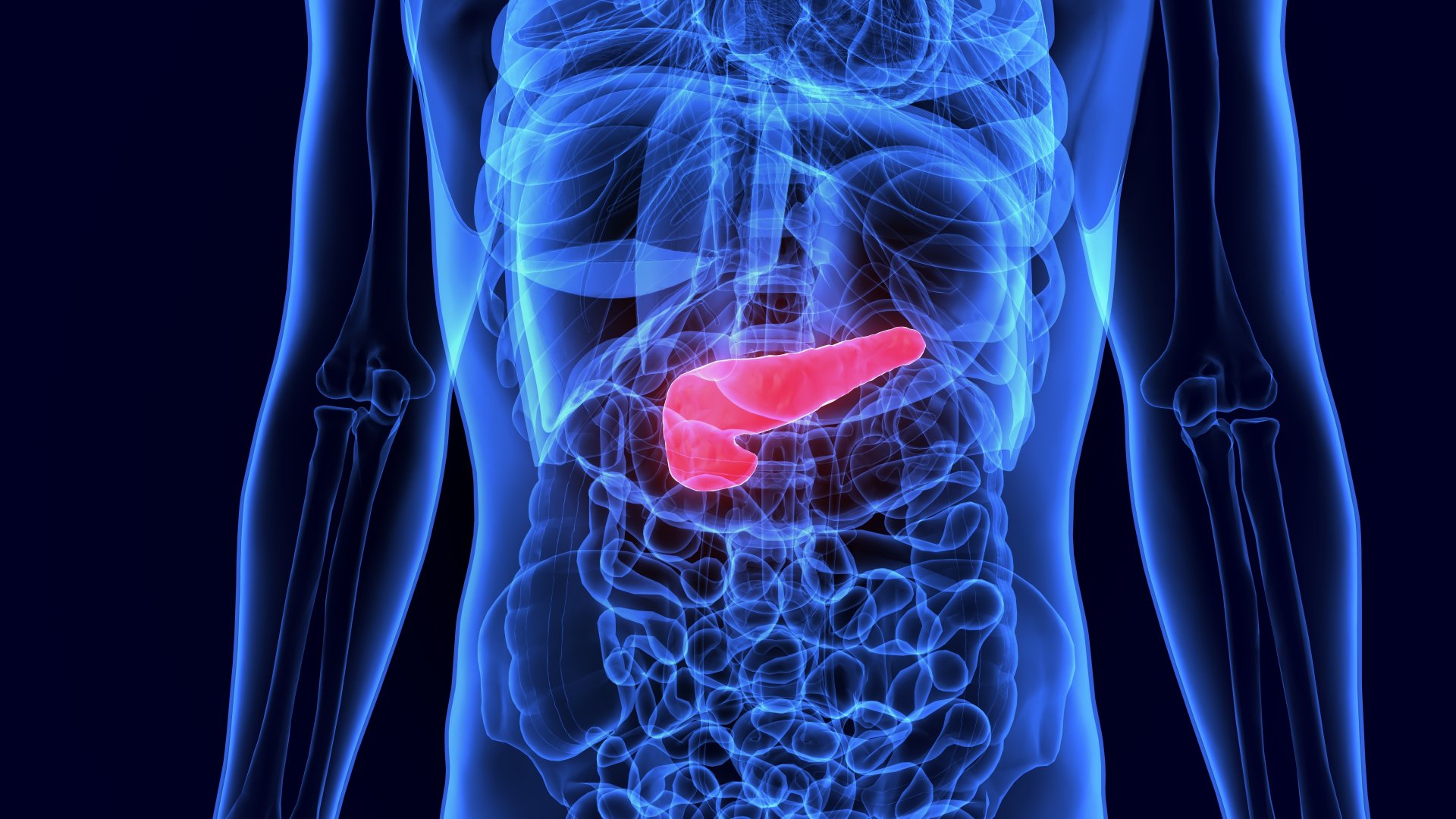 Endocrine Disorders Endocrine Disorders