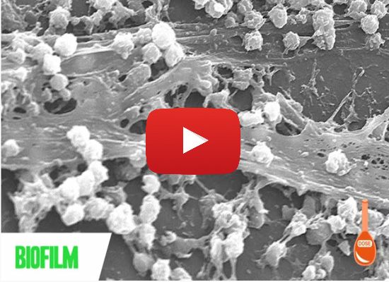 BACTERIA BIOFILM - First step in PERSISTENT MICROBIAL INFECTION