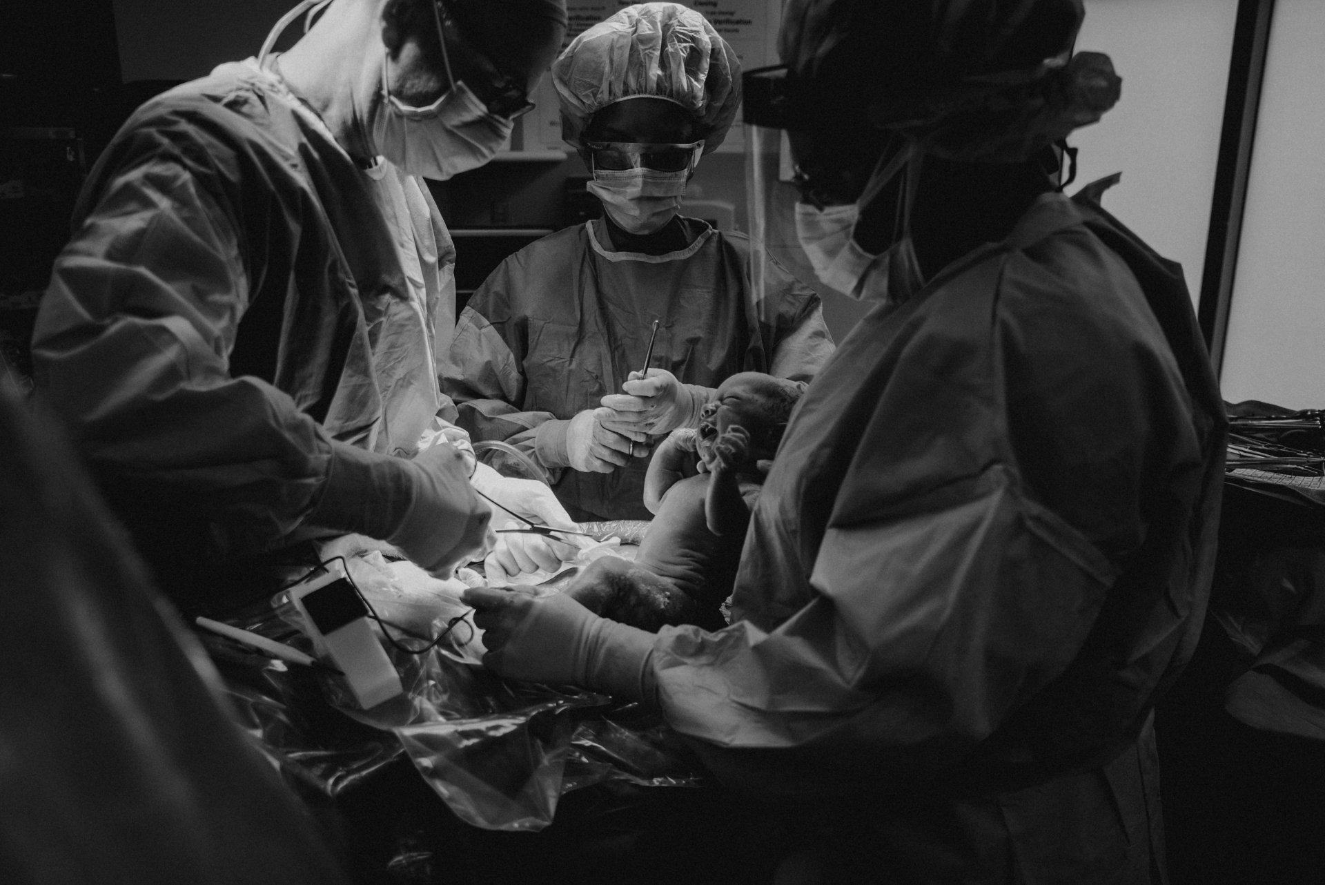 Piedmont Newnan Birth | Breech C-Section