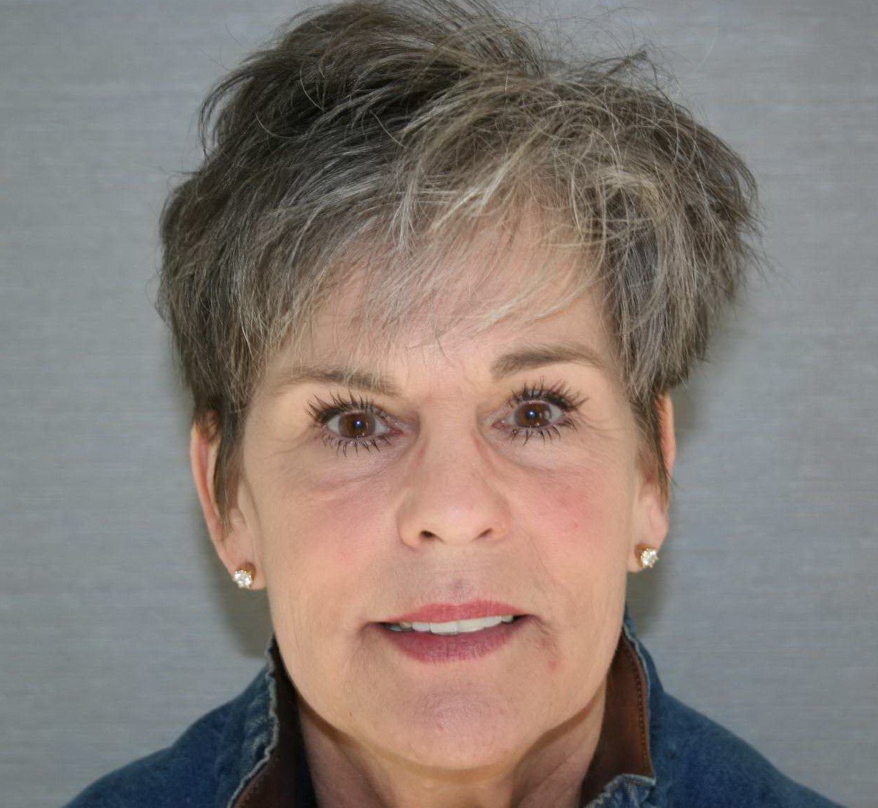 Plastic Surgeon Connecticut | Boris Goldman, MD