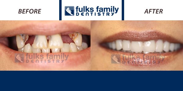 Smile Gallery | Fulks Family Dentistry | Bryant