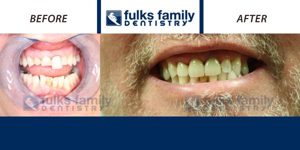 Smile Gallery | Fulks Family Dentistry | Bryant