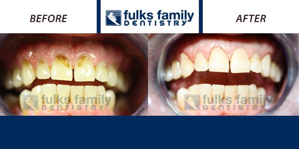 Smile Gallery | Fulks Family Dentistry | Bryant