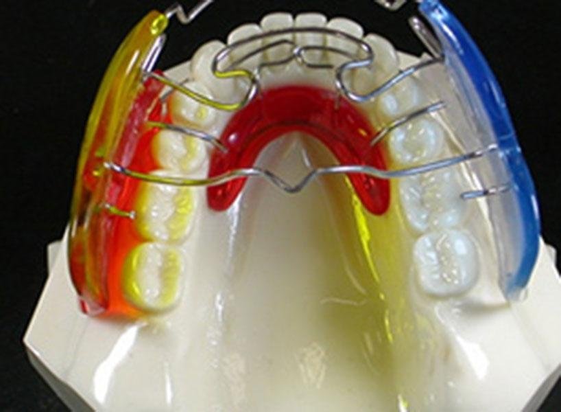 Ortodonzia a Roma | Studio Dentistico Ortuso