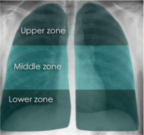 RENTGENANATOMIJA PLUĆA, SRCA I KRVNIH SUDOVA
