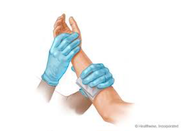 PRVA POMOĆ KOD RANA