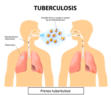 TUBERKULOZA