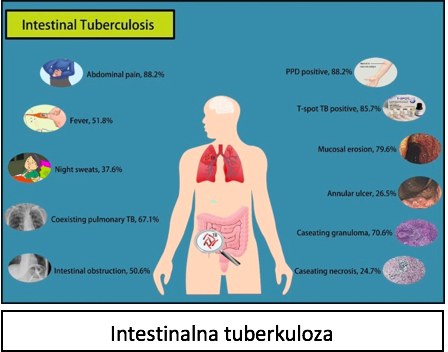 TUBERKULOZA