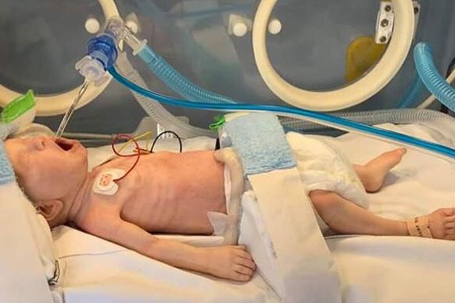 Lifecast Body Simulation | Babies