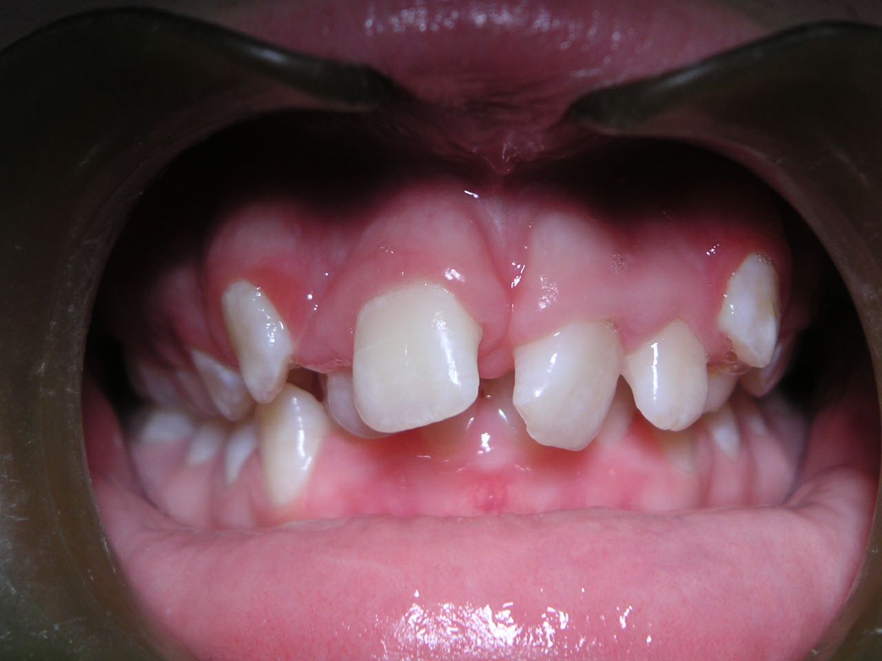 The Dental Orthodontic Centre| Orthodontist | Winthrop, WA