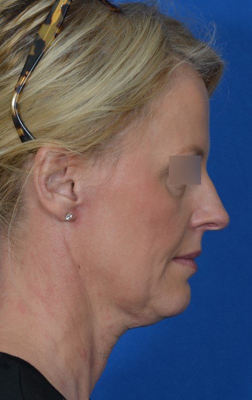 Your Guide To The Modern Mini Facelift