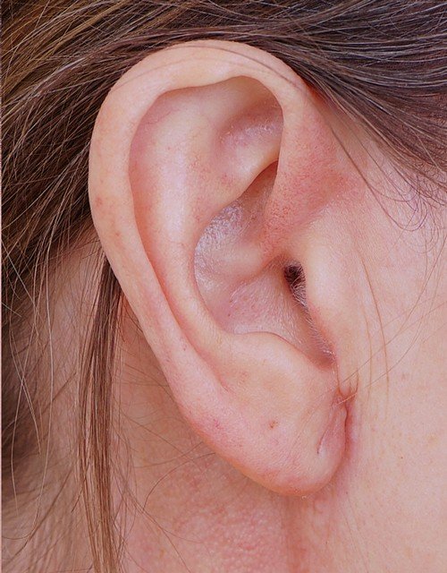 Common Earlobe Issues and Procedures To Correct Them