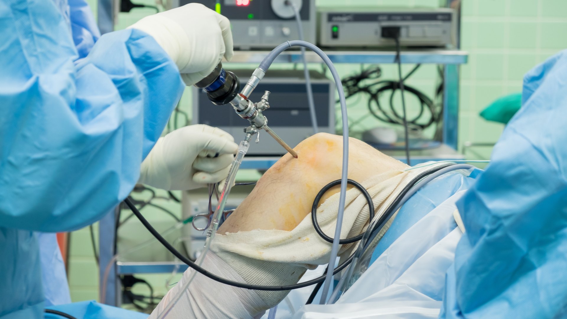 Meniscal Tears, Meniscus Surgery, Meniscus Rupture - Treatment