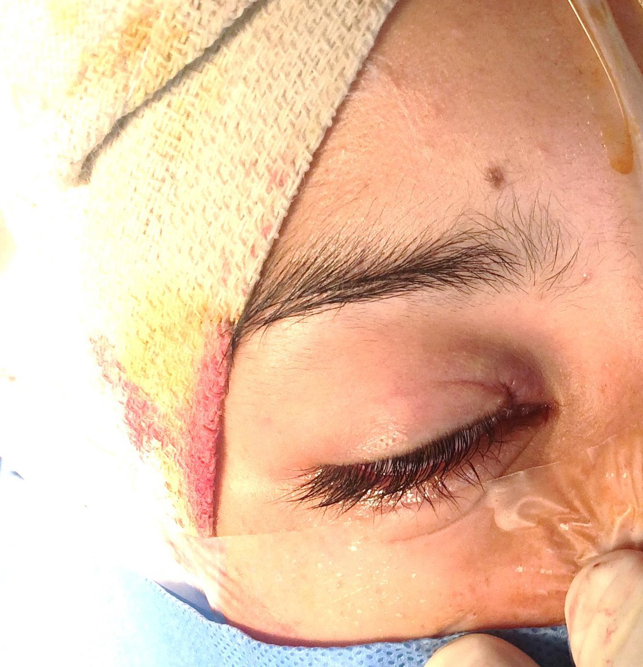 TEAM | ARLINGTON LOUDOUN PEDIATRIC OPHTHALMOLOGY | ARLINGTON & STERLING, VA