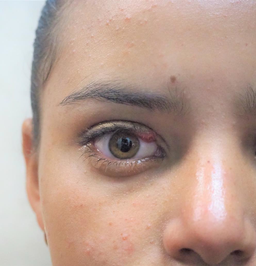 TEAM | ARLINGTON LOUDOUN PEDIATRIC OPHTHALMOLOGY | ARLINGTON & STERLING, VA