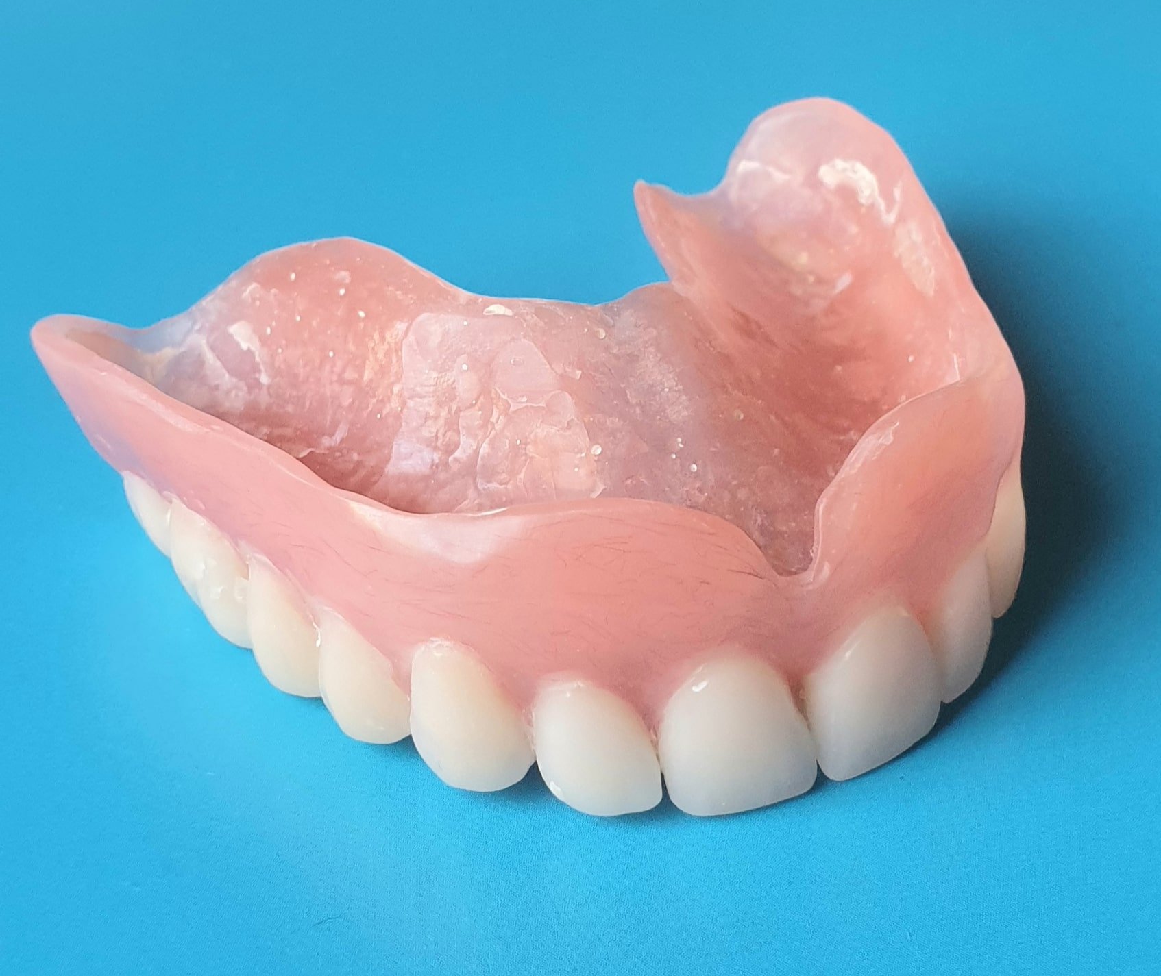 Protesi mobile | Roma Prati | Laboratorio Odontotecnico Carlandrea Viaggi