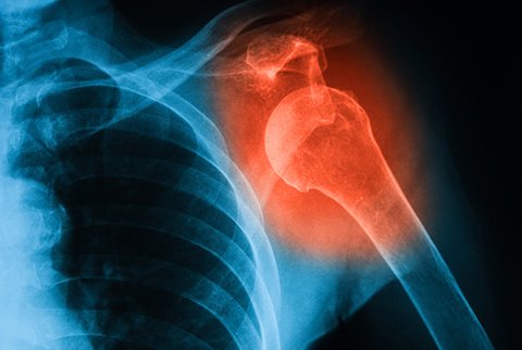 Dislocation Doctors Specialists: Shoulder, Knee in New Jersey