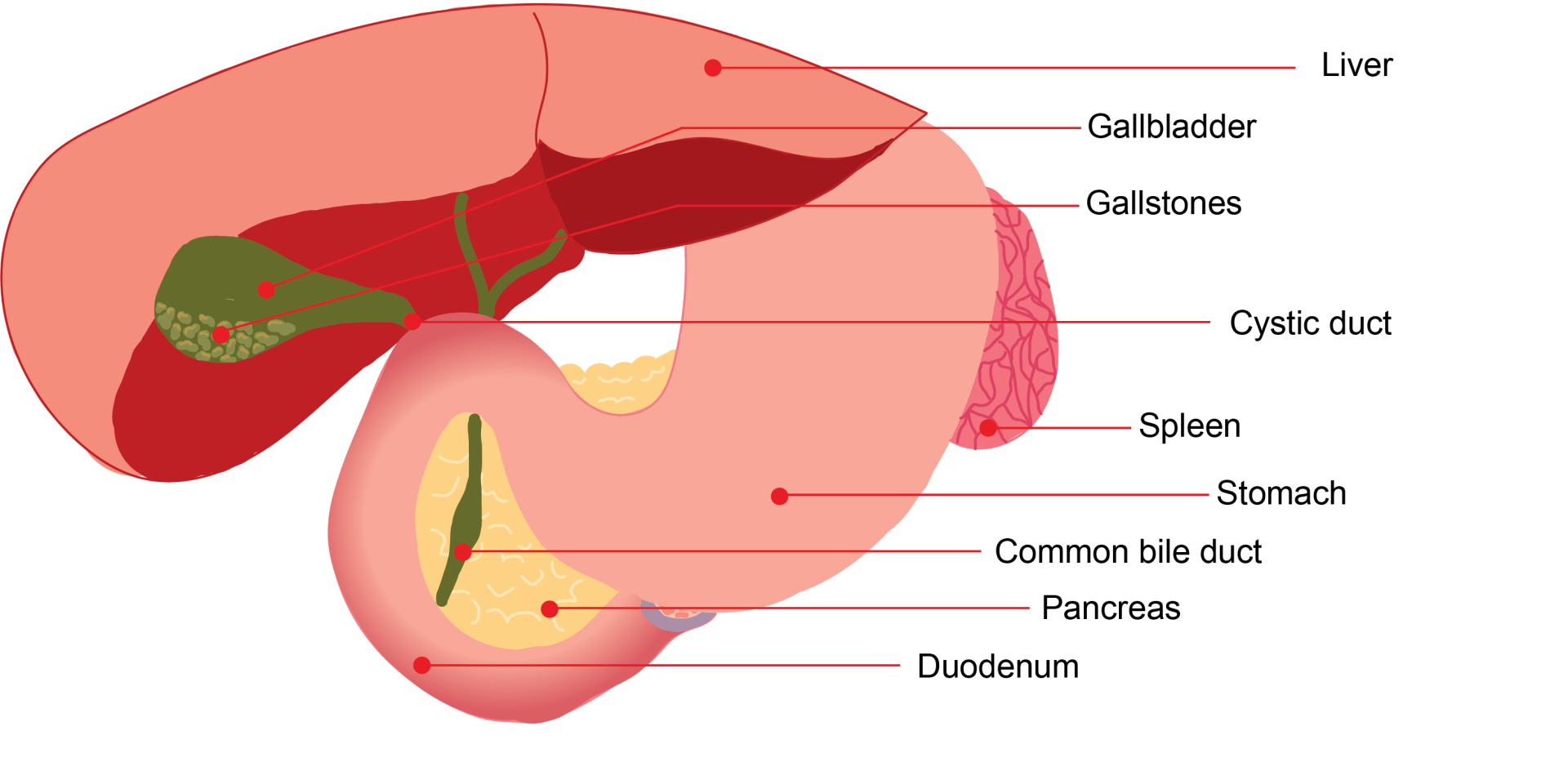 Gallstones | Gallbladder Surgery Central Coast