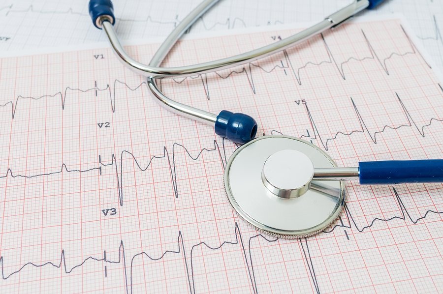 Electrocardiogram (EKG or ECG) | Medical Center of Marin | Urgent Care ...