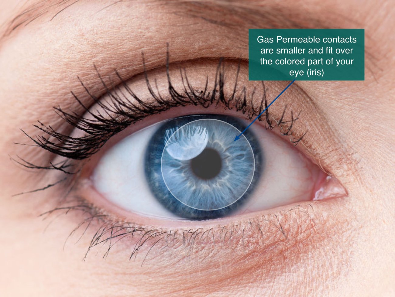 Gas Permeable Contact Lenses in Oklahoma City