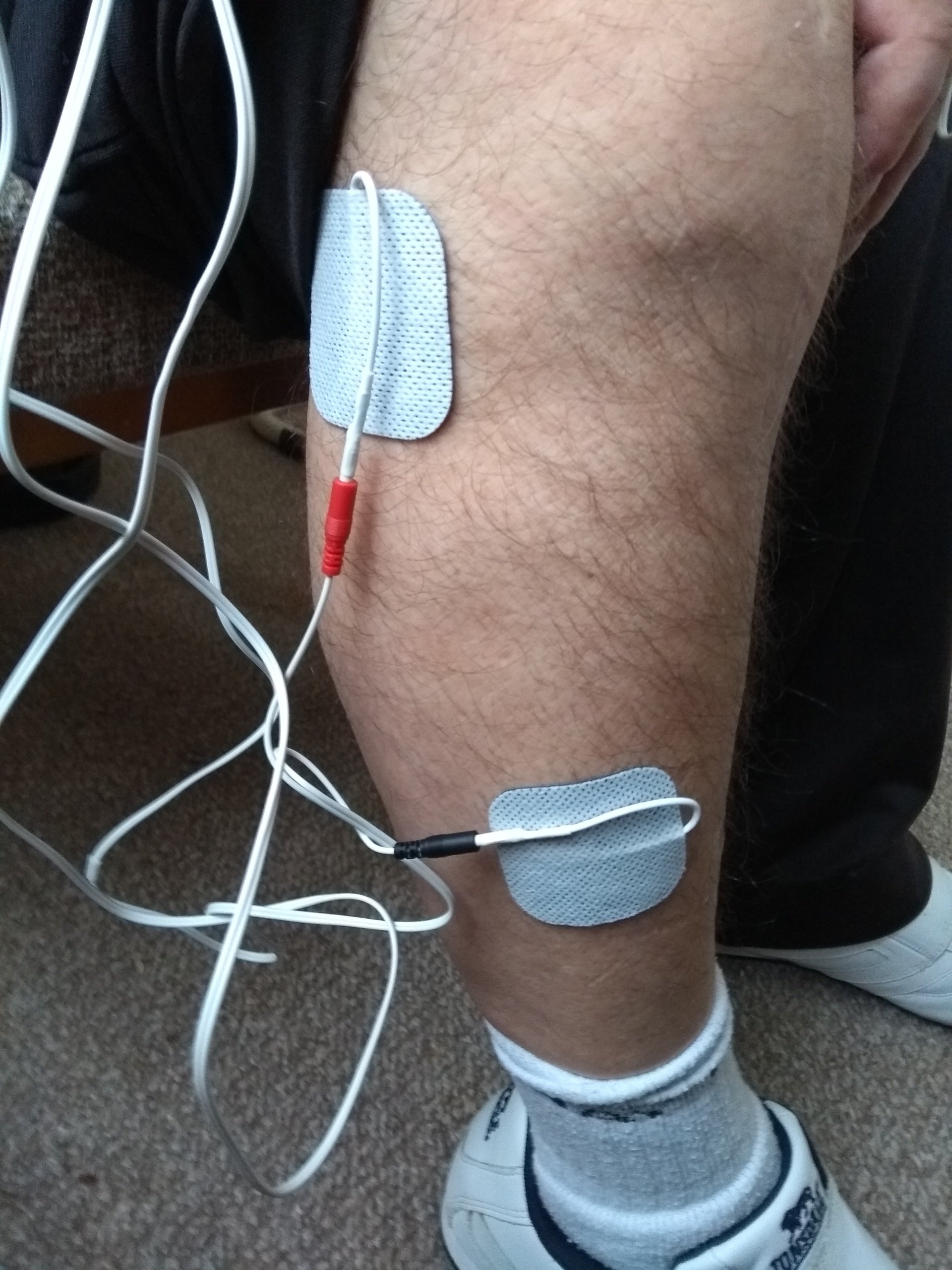 More on Electrical Muscle Stimulation