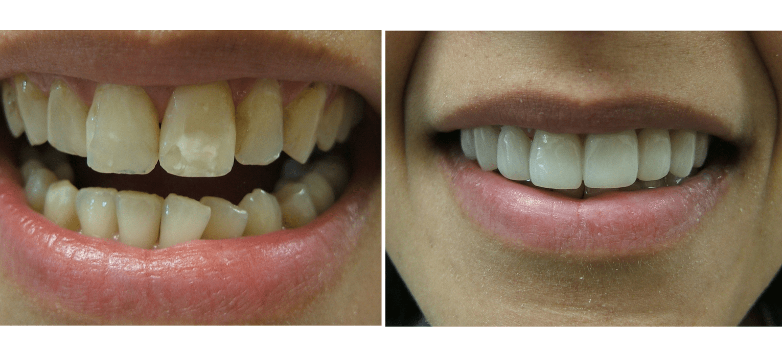 Family Dentist | Glen Allen, VA | Dr. Babik & Associates