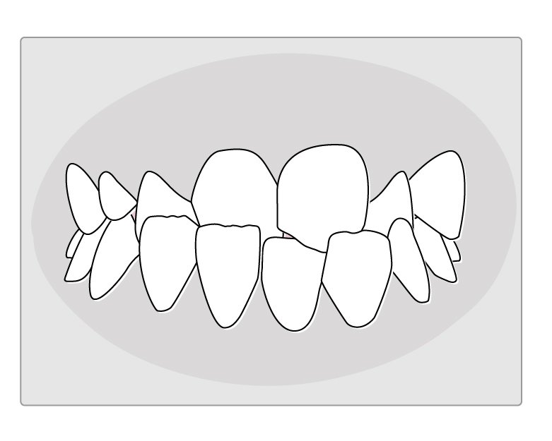 Das erste Mal zum Kieferorthopäden? Erste Abklärung Zahnspange