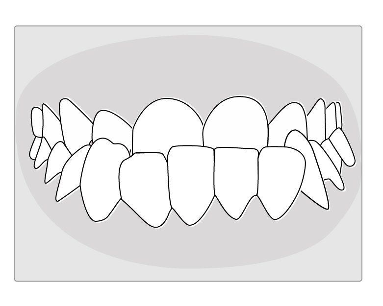 Das erste Mal zum Kieferorthopäden? Erste Abklärung Zahnspange
