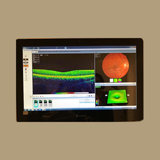 OCT eye scans from Penny & Hayter Opticians