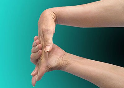 Carpal Tunnel Syndrome Self Test