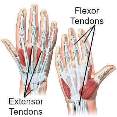 How to Identify and Eliminate Wrist Tendonitis Pain