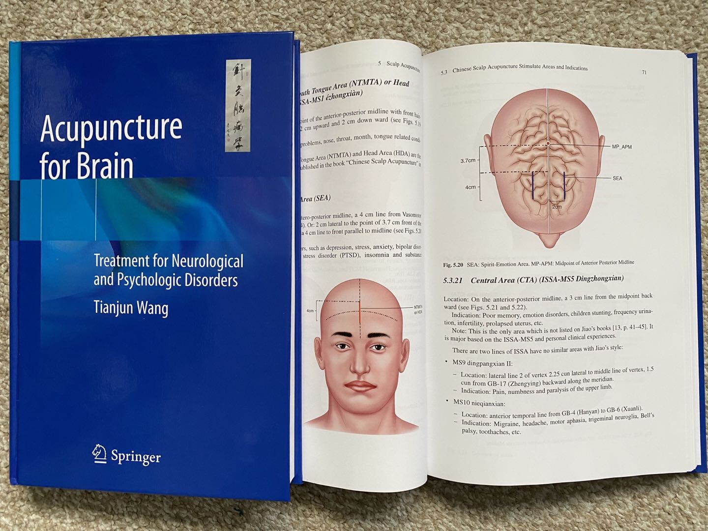 Authored Book: Acupuncture for Brain: Treatment for Neurological and ...