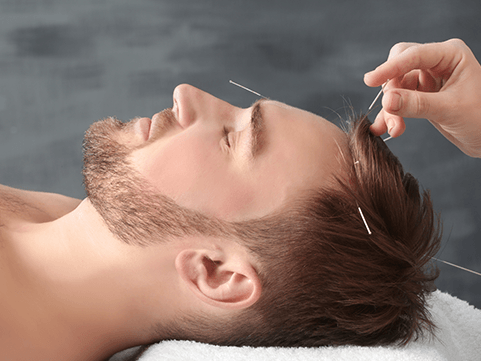 Acupuncture Training Ilford, Essex: TJ Acupuncture