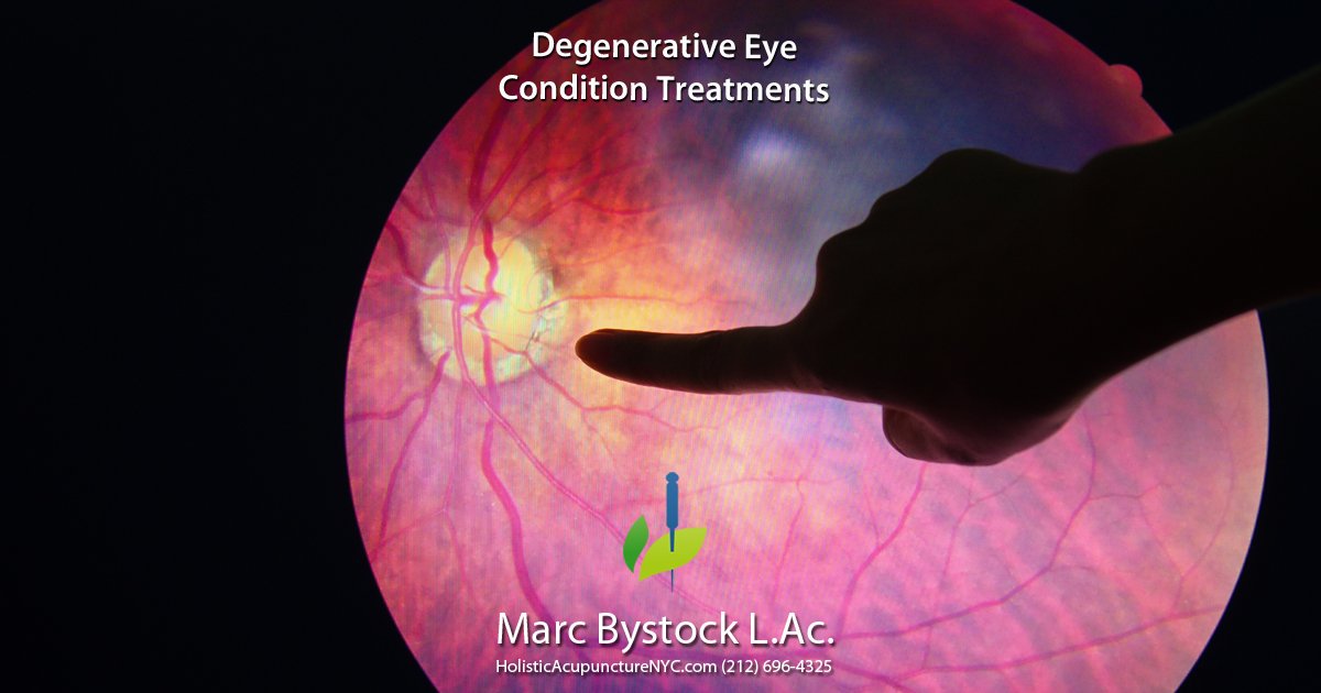 Degenerative Eye Condition Treatments NYC