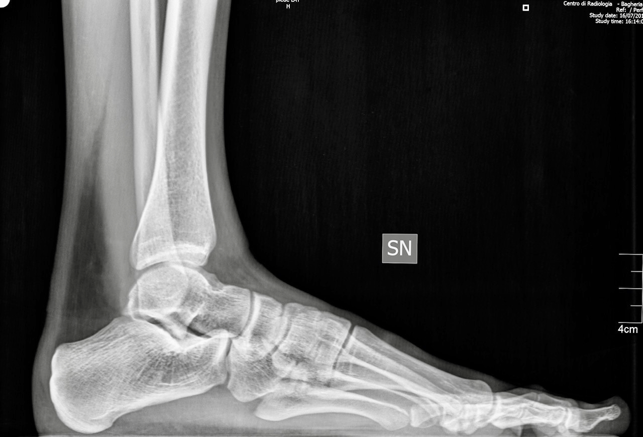 Radiologia digitale diretta RX Bagheria, Palermo | Centro di Radiologia ...