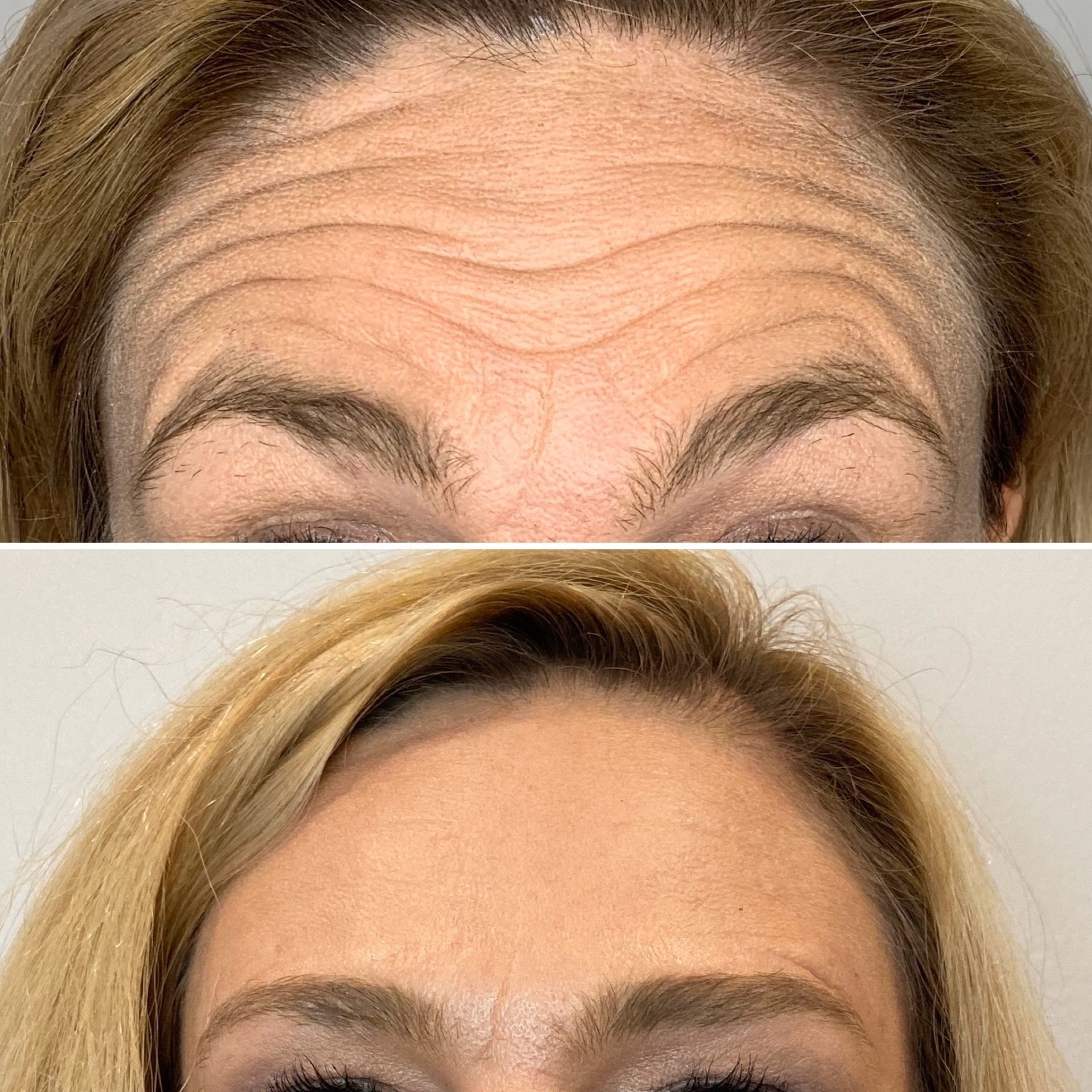 MedSpa Before & After Gallery | MedSpa Treatments Photo Gallery ...