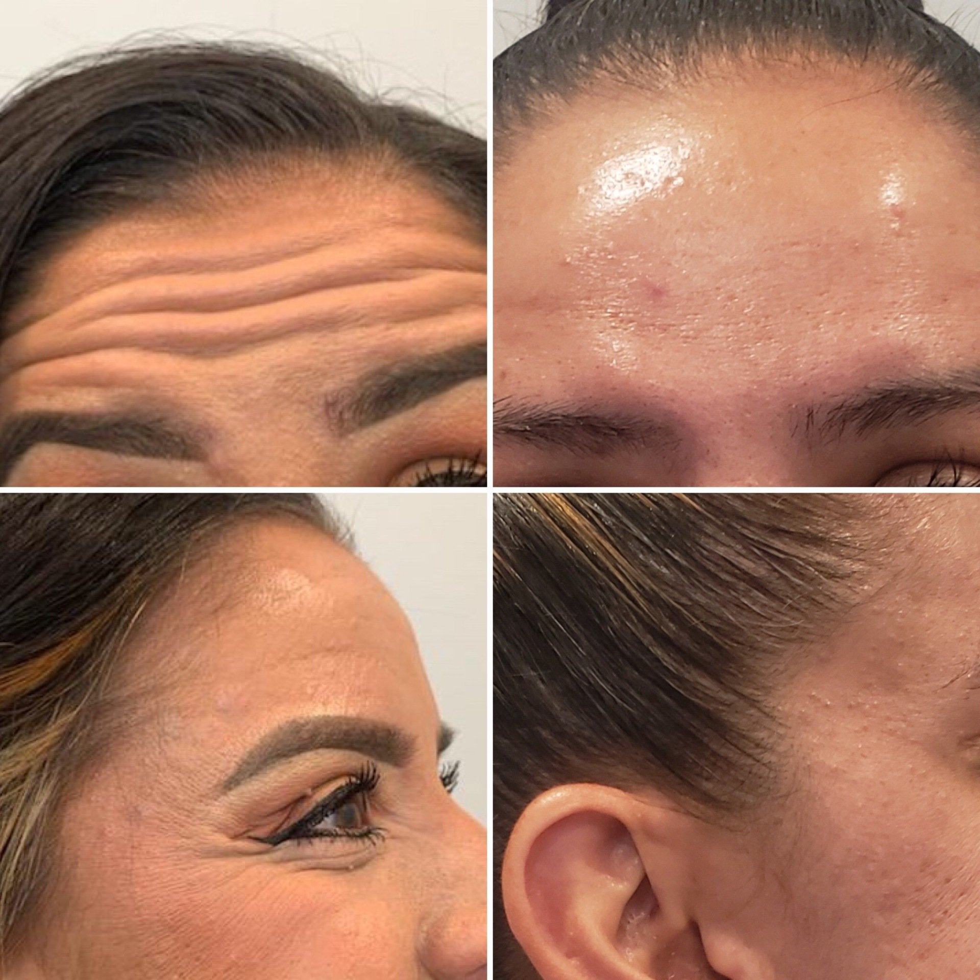 MedSpa Before & After Gallery | MedSpa Treatments Photo Gallery ...