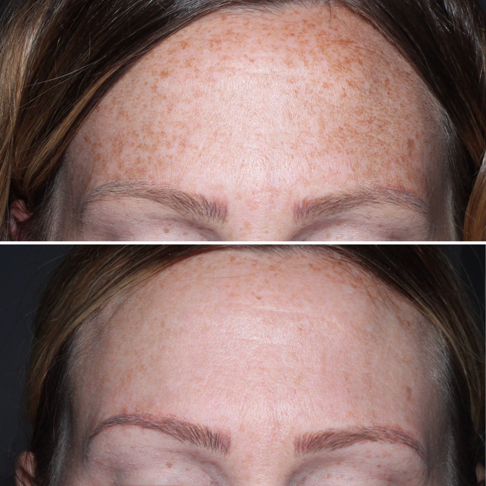 MedSpa Before & After Gallery | MedSpa Treatments Photo Gallery ...